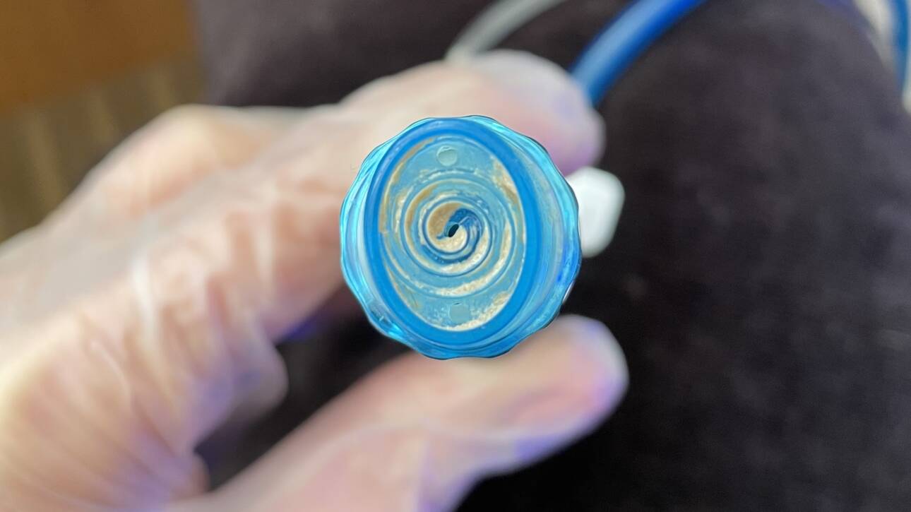 Hydrafacial For Hair Growth: A Positive Solution – En Sante Clinic and ...